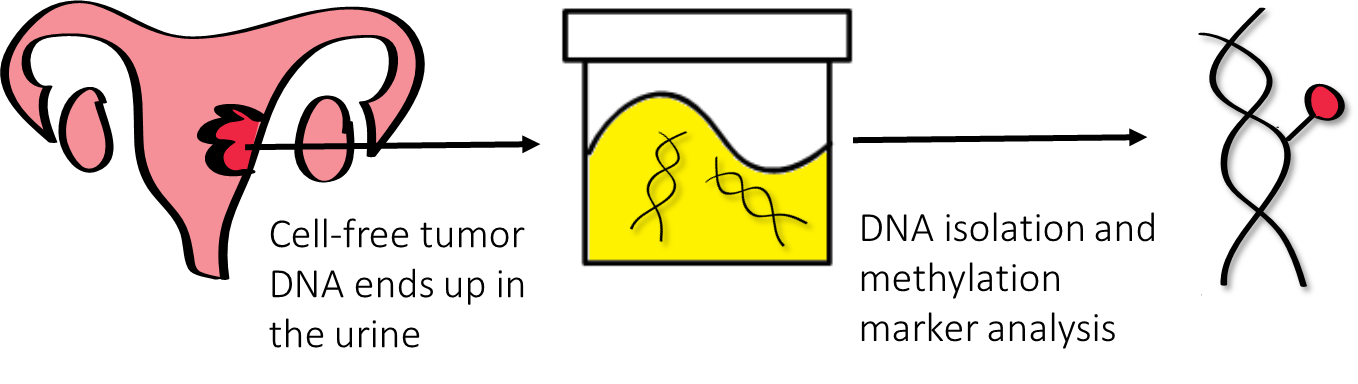 First Evidence for Non-Invasive Endometrial Cancer Detection in Urine | Amsterdam UMC